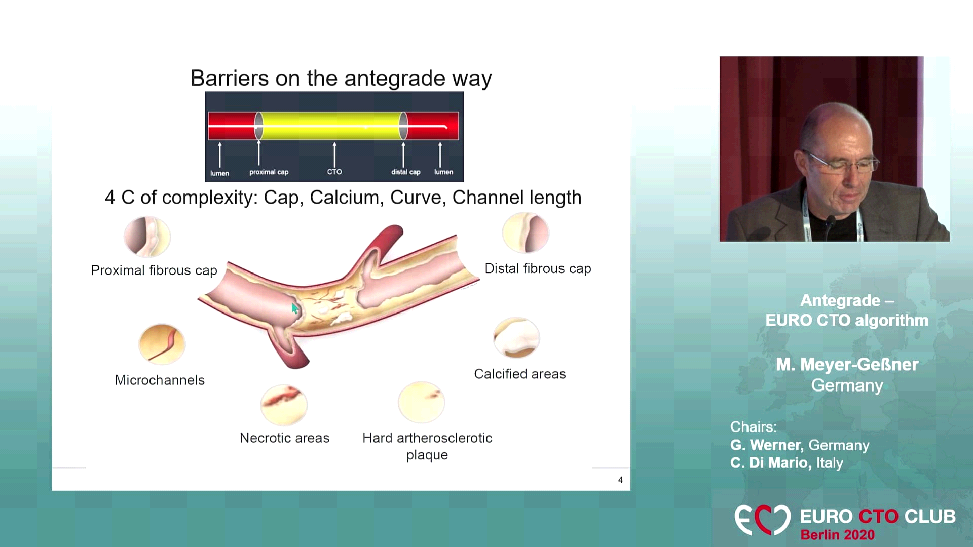 🎤 Session 1 - Antegrade – EURO CTO algorithm